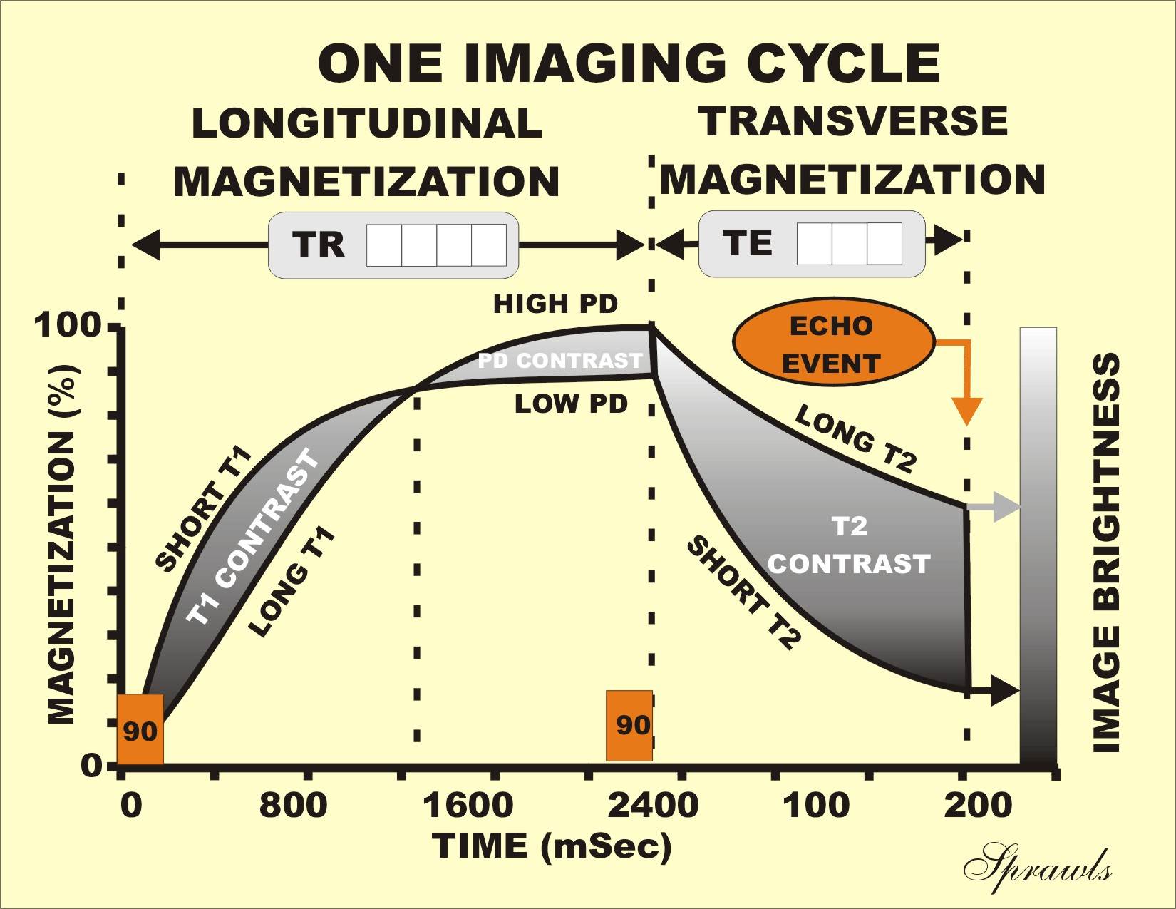 Magnetic Resonance Imaging
